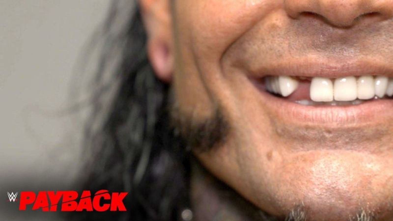 6 WWE Superstars who've had their teeth knocked out in the ring