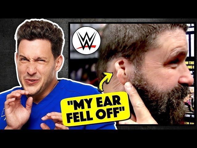 What's the truth about the "lazy eye" of Shawn Michaels?