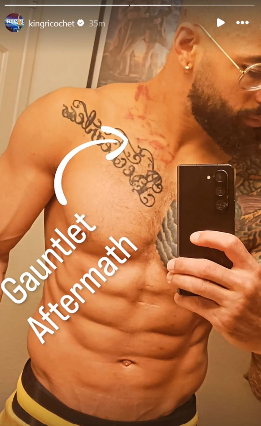 Ricochet shows off wounds following WWE RAW Gauntlet Match