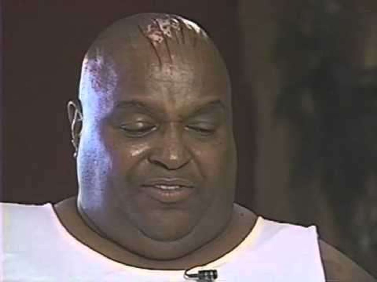 5 Wrestlers with the worst blade scars